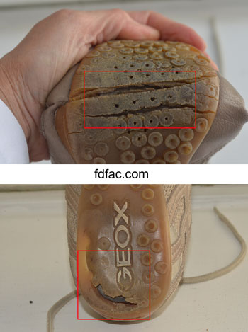 Foot Pain | Dr. Jenny Sanders Shoe Blog