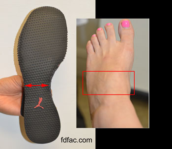 Foot Pain | Dr. Jenny Sanders Shoe Blog